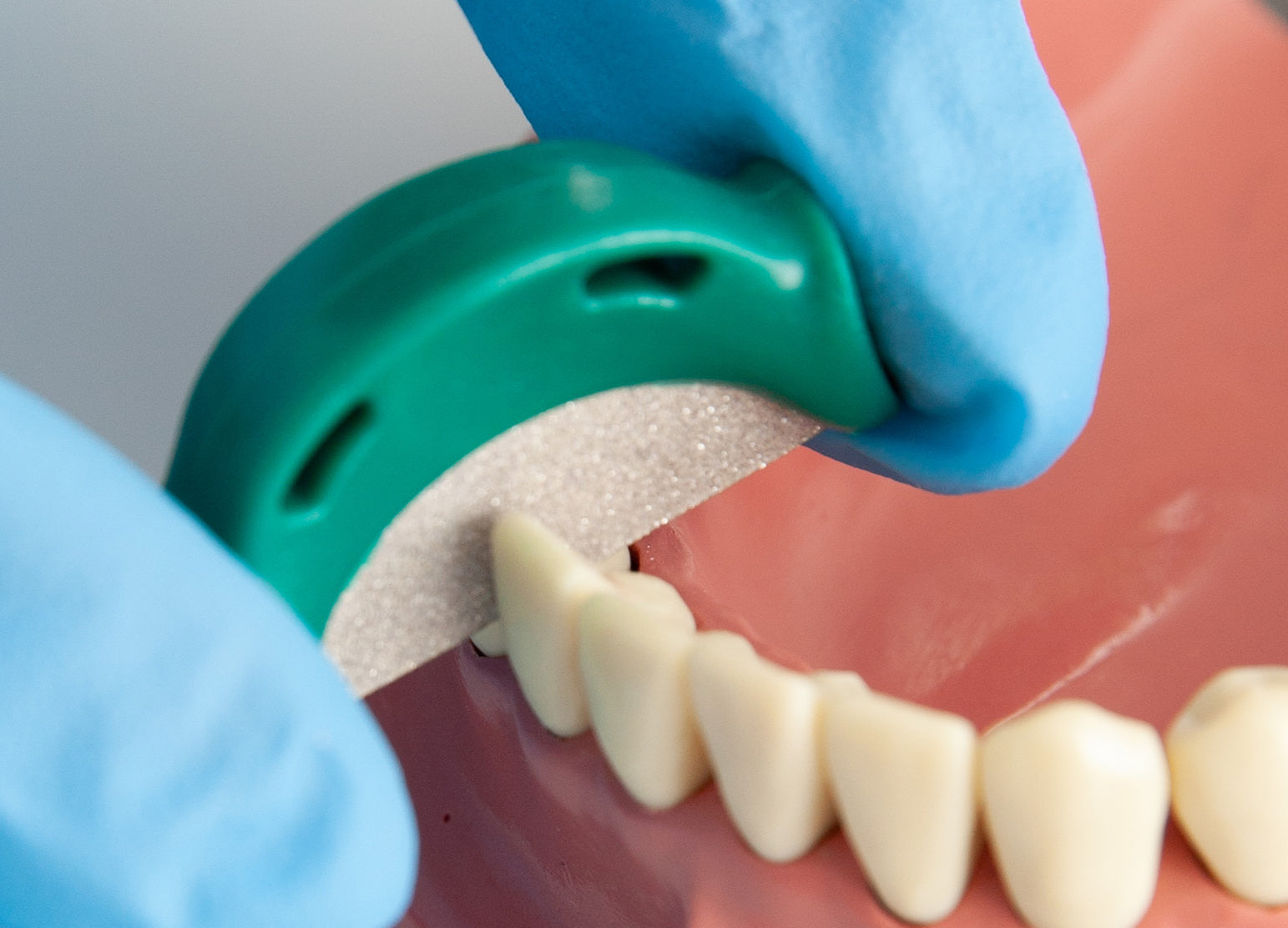 An Introduction to Interproximal Reduction (IPR) for your patients ...