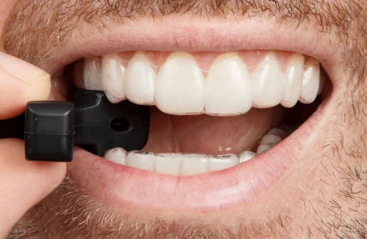 Optimise the seating of clear retainers with Munchies® Maintain – 1122CORP