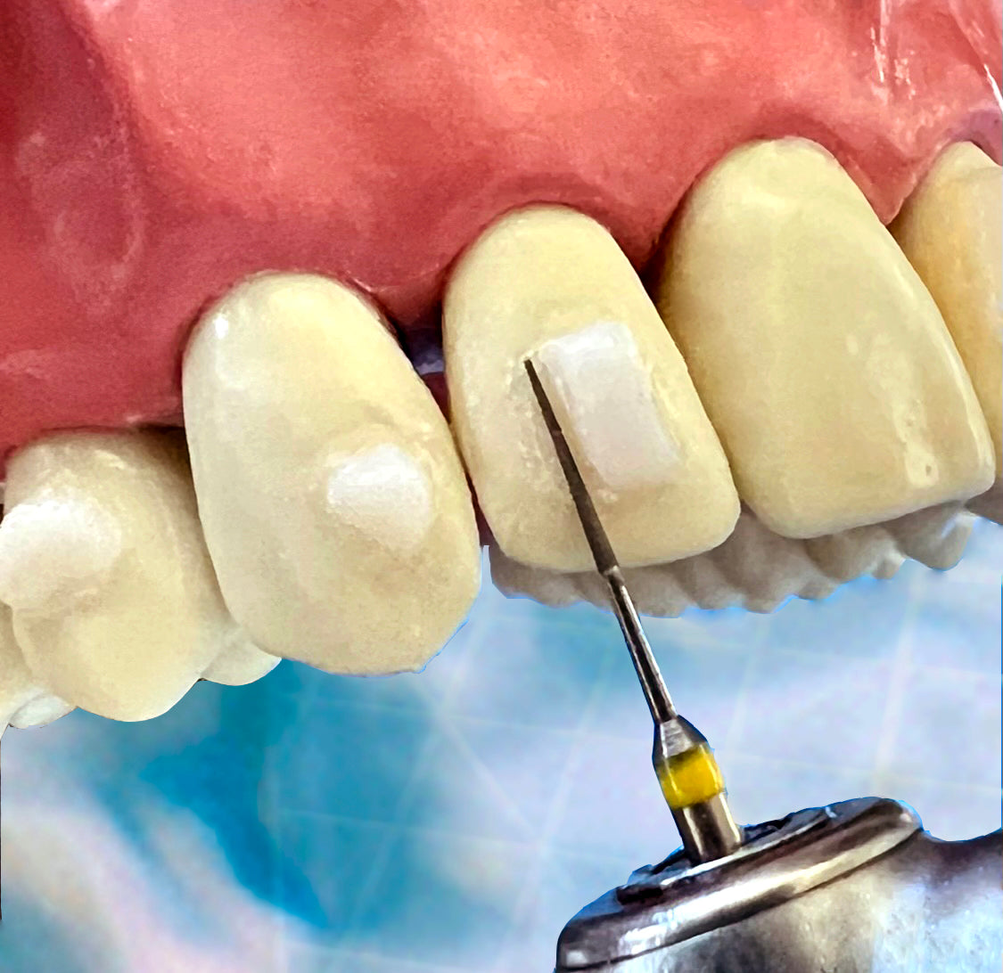 Composite Attachment Bur (CAB) - EXTRA SUPER FINE 6.0 (2, 5, 10 pks ...